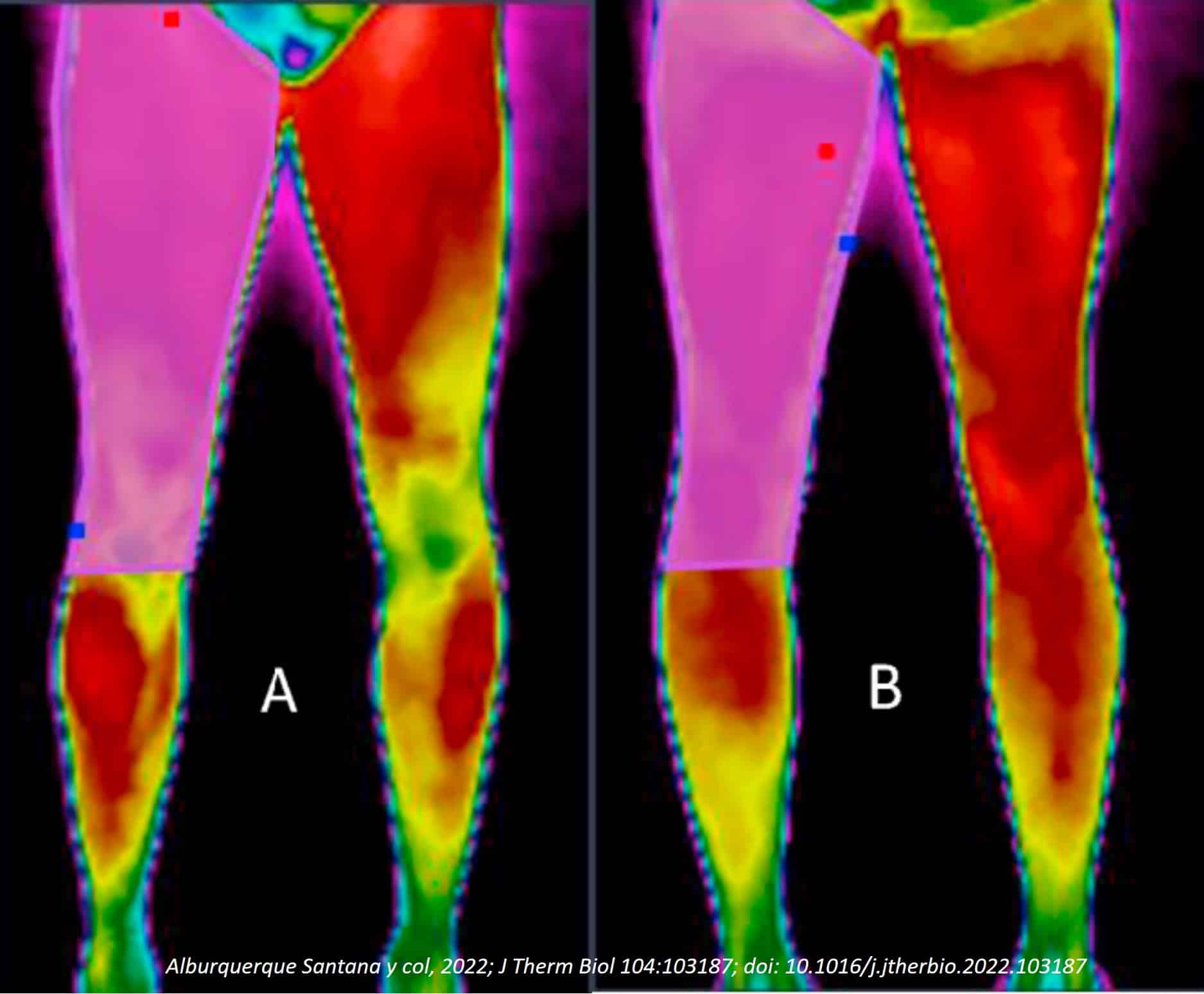 Termografía y daño muscular - Fisiología del Ejercicio